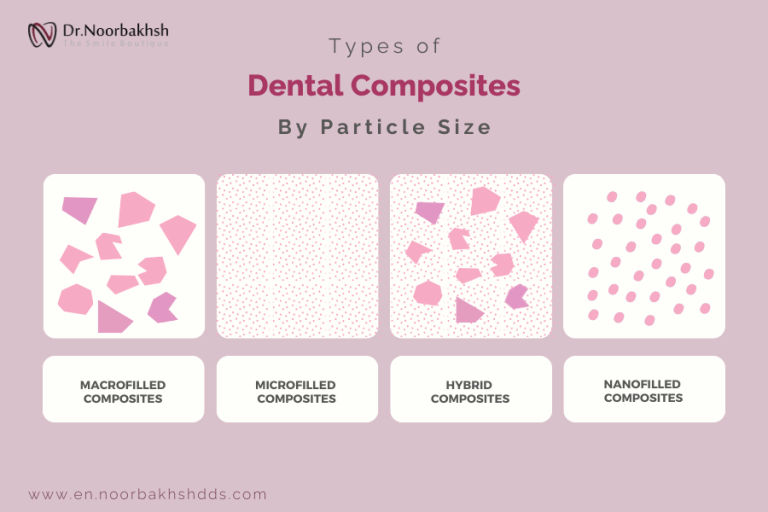 Top 5 Dental Composite Brands in 2025 - Pros & Cons Reviewed!