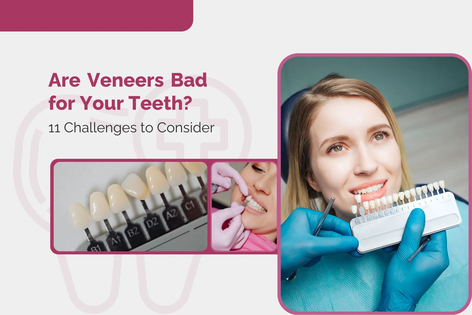 Are Veneers Bad for Your Teeth? 11 Challenges